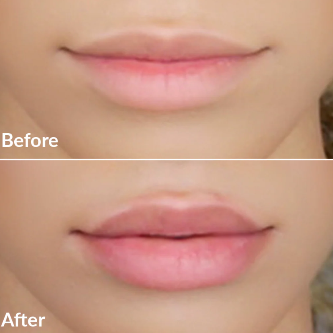 PMD Kiss Lip Plumping System Pink Anti-Aging Lip Enhancing Treatment ...
